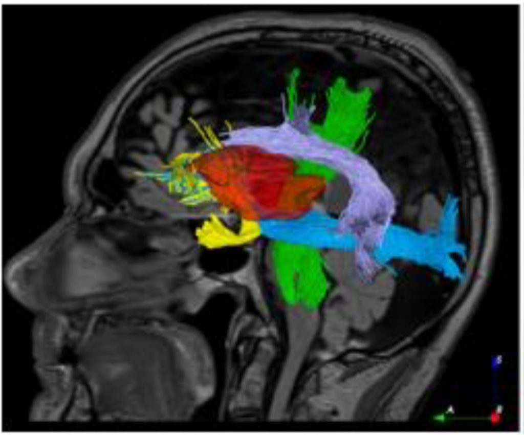 Data – Cerevis 2018