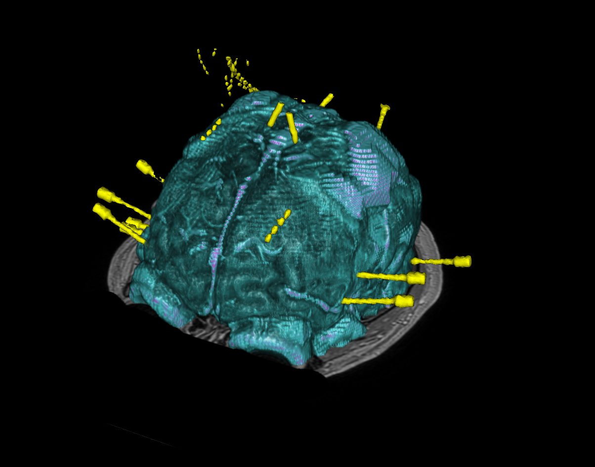 Data – Cerevis 2018