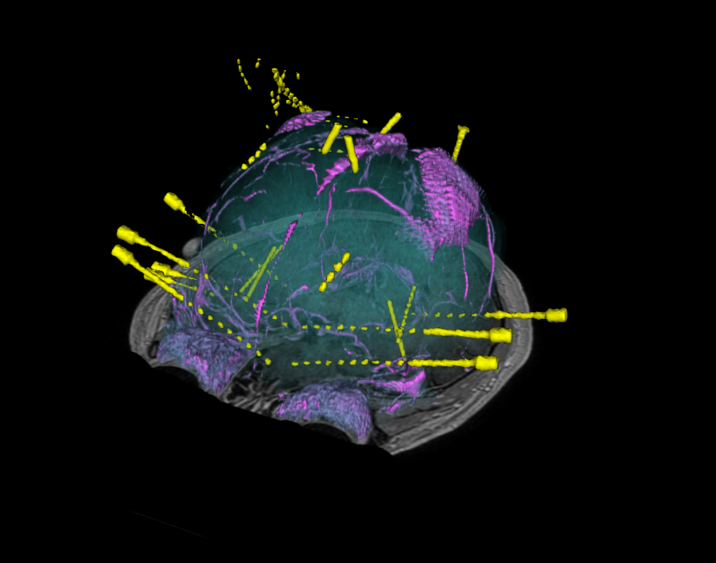 Data – Cerevis 2018