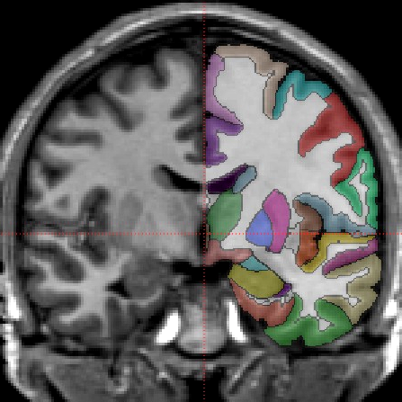 Data – Cerevis 2018